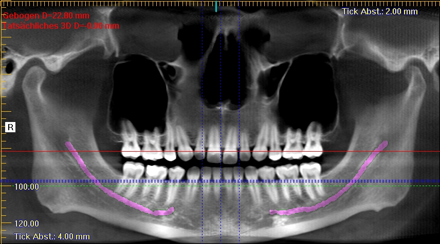 Digitale Volumentomographie in der Zahnarztpraxis